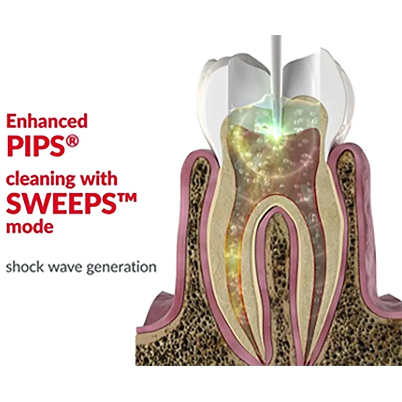 Fox Creek Endodontics | Endodontist Conroe TX | Root Canal Conroe TX